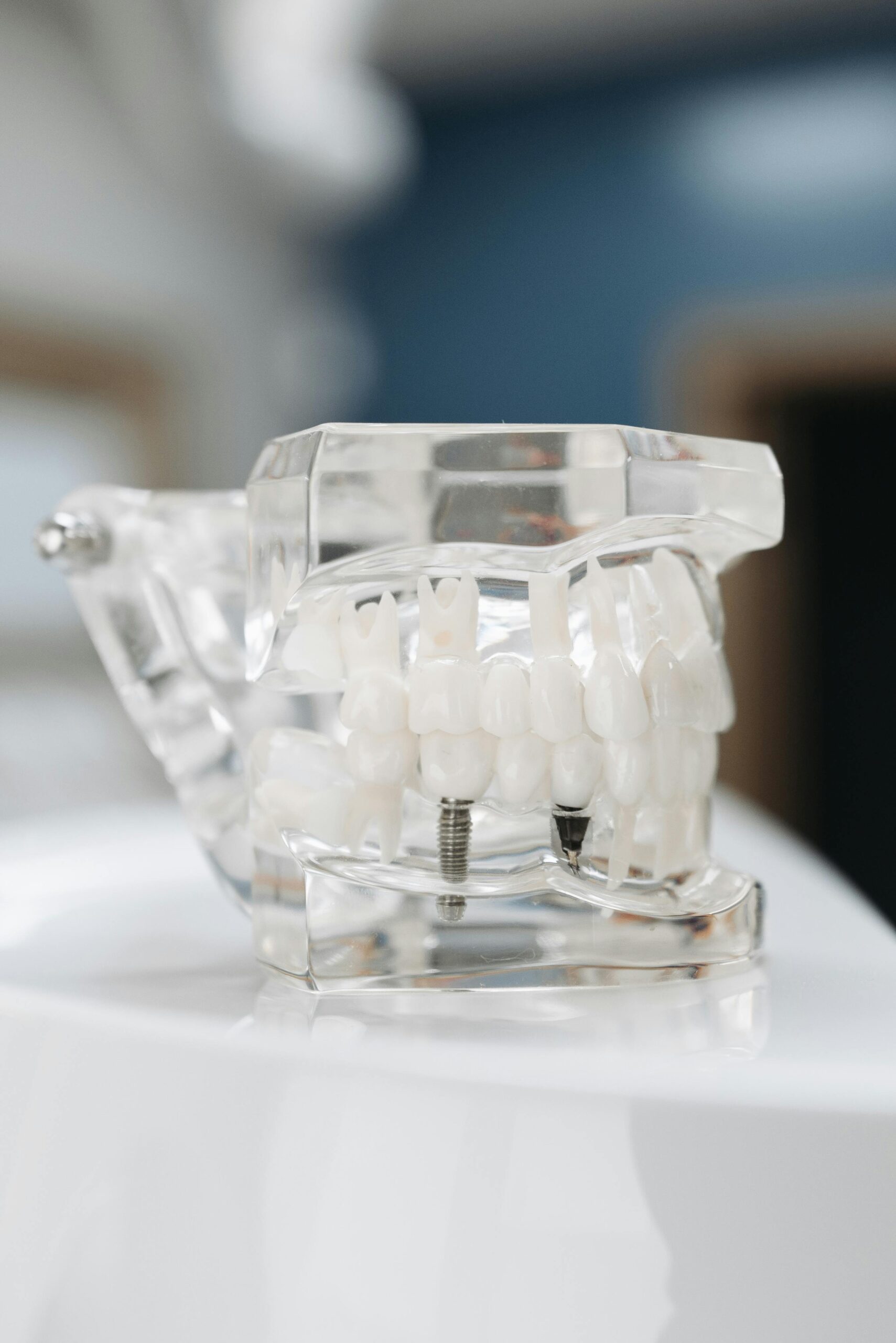 Dental implants for elderly | Universal Smiles Dental